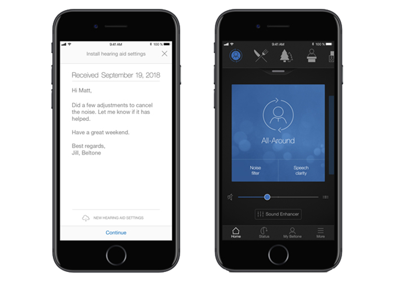 Beltone Rely Hearing Aids | Reviews and Prices