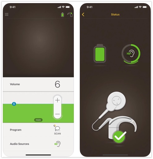 Cochlear Nucleus® 8 Cochlear Implants | Reviews and Prices